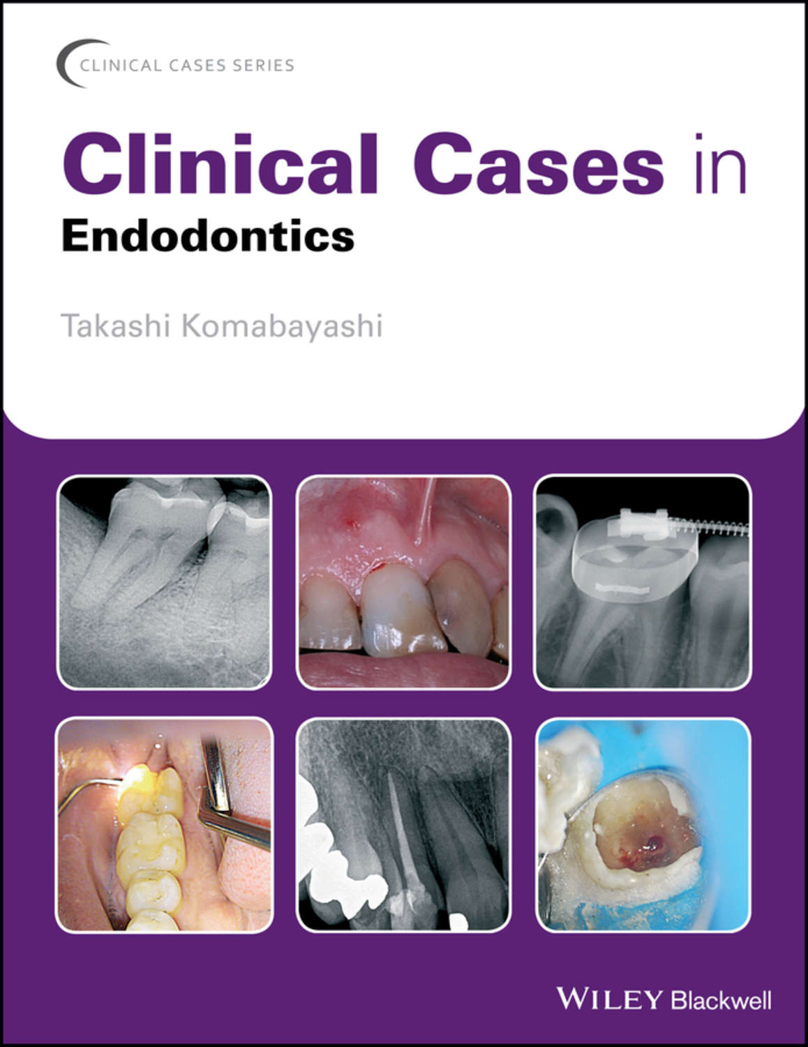 Clinical Cases In Endodontics Pdf clinical-cases-in-endodontics-pdf